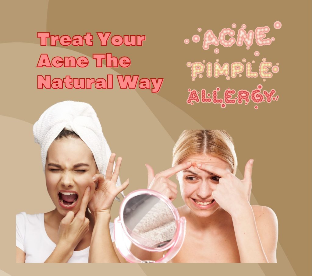 Tea Tree Acne Gel Natural Gel | Green Herbology